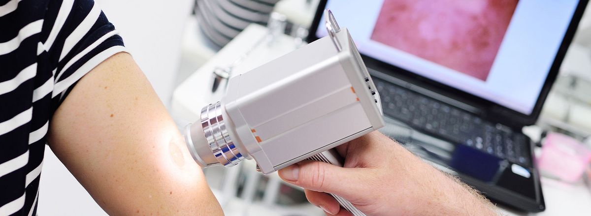 Real-Time AI Scanning revolutionizing Skin Cancer Recognition | SYSGO